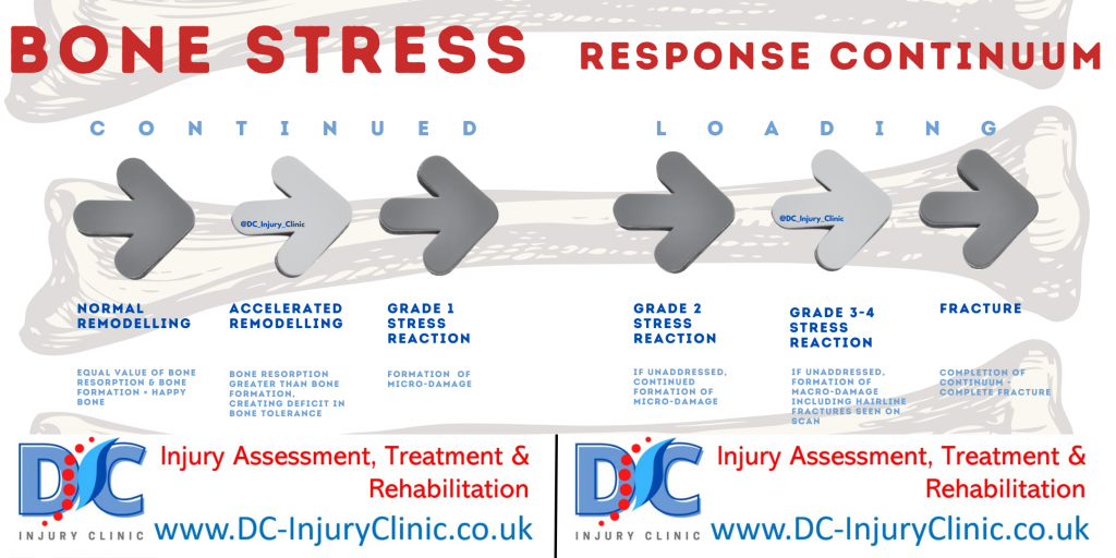 “Shin Splints” – DC Injury Clinic